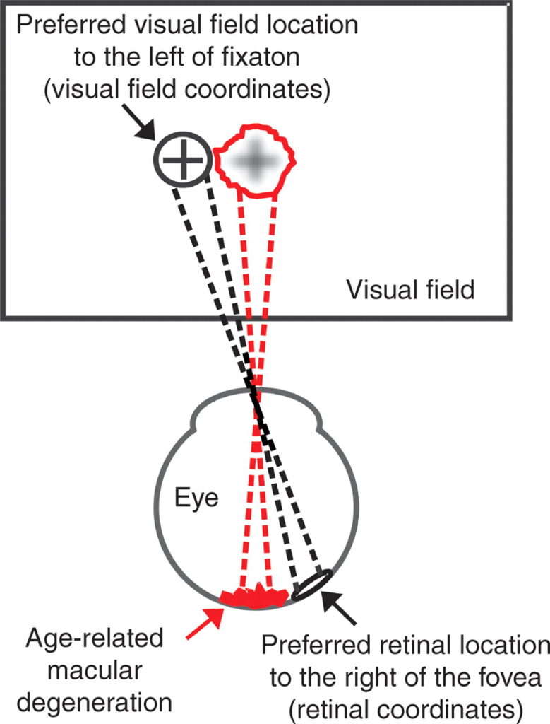 peripheral vision - Ensight Skills Center